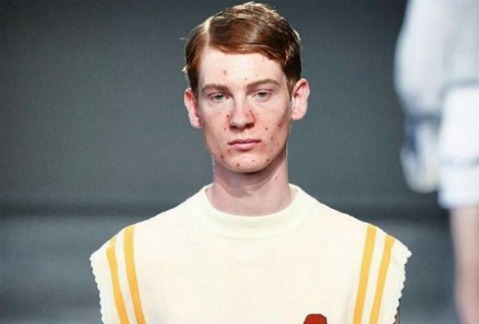 Modelos con acné caminan en pasarela de Milán - Grupo Milenio