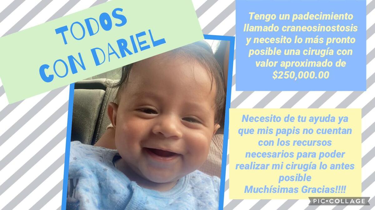Gómez Palacio. Dariel necesita una operación para crecer- Grupo Milenio