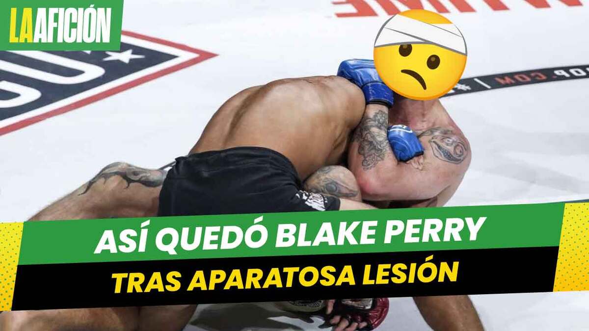 Blake Perry termina con la nariz desfigurada tras perder pelea en UFC ...