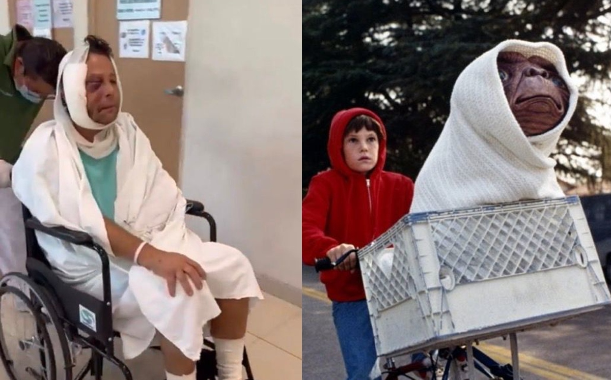 Internautas hacen memes de Adame tras operación; lo comparan con ET ...