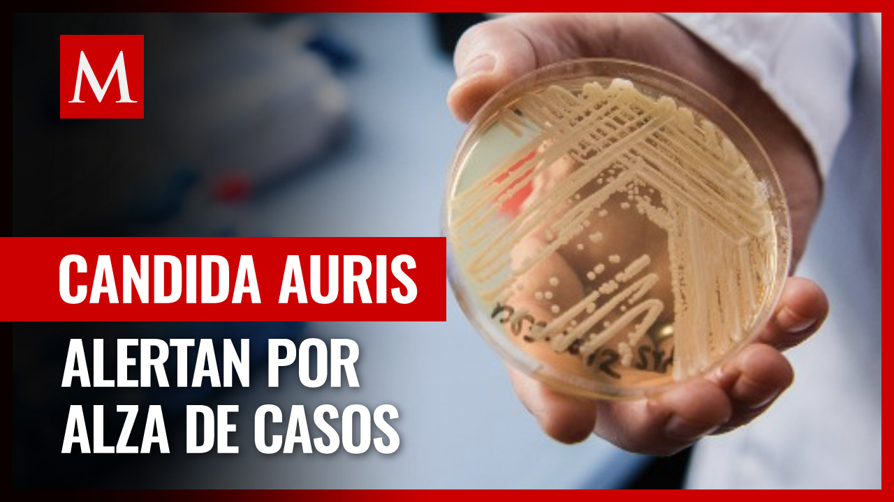 Candida auris: Suben casos de hongo en EU; se propaga fácilmente- Grupo ...