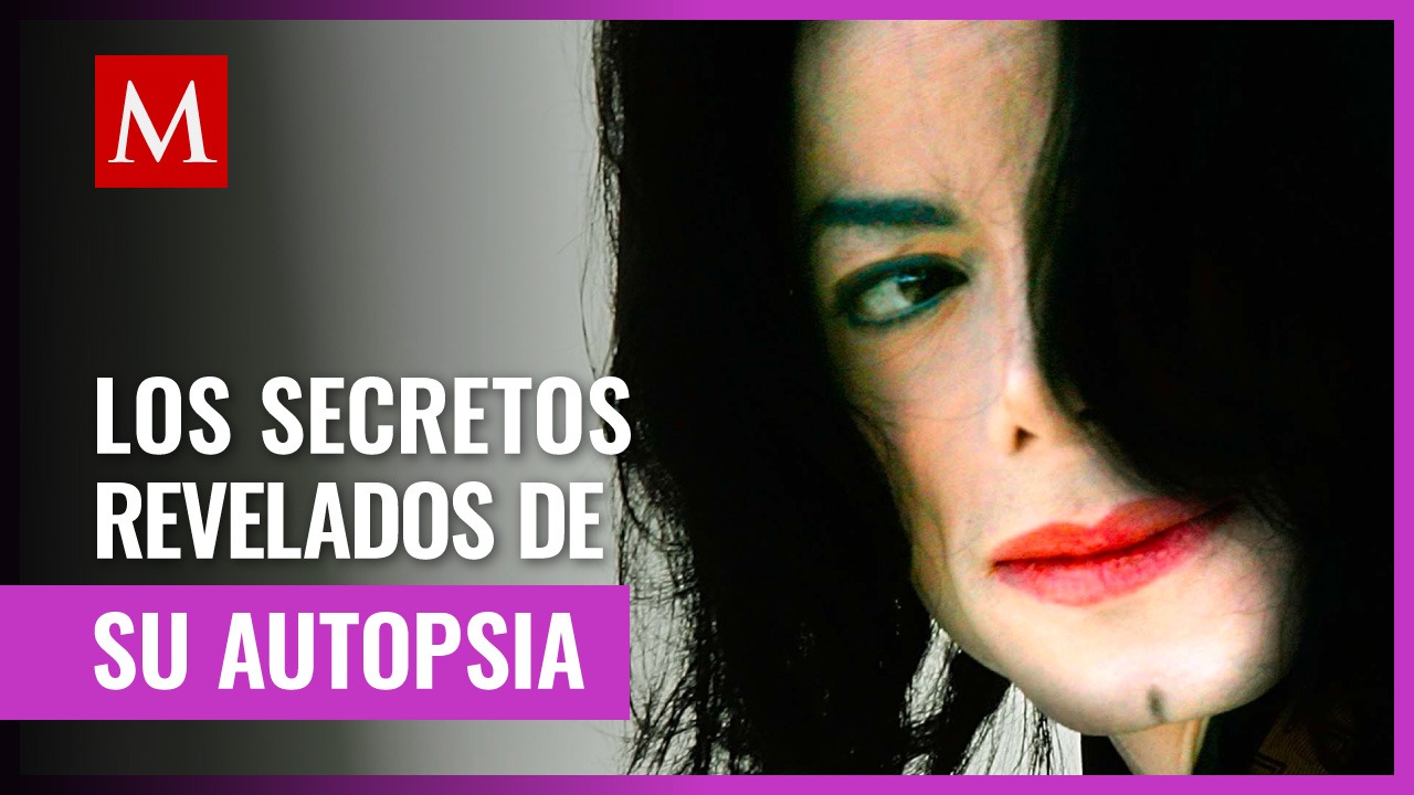 Michael Jackson: qué dice su autopsia- Grupo Milenio