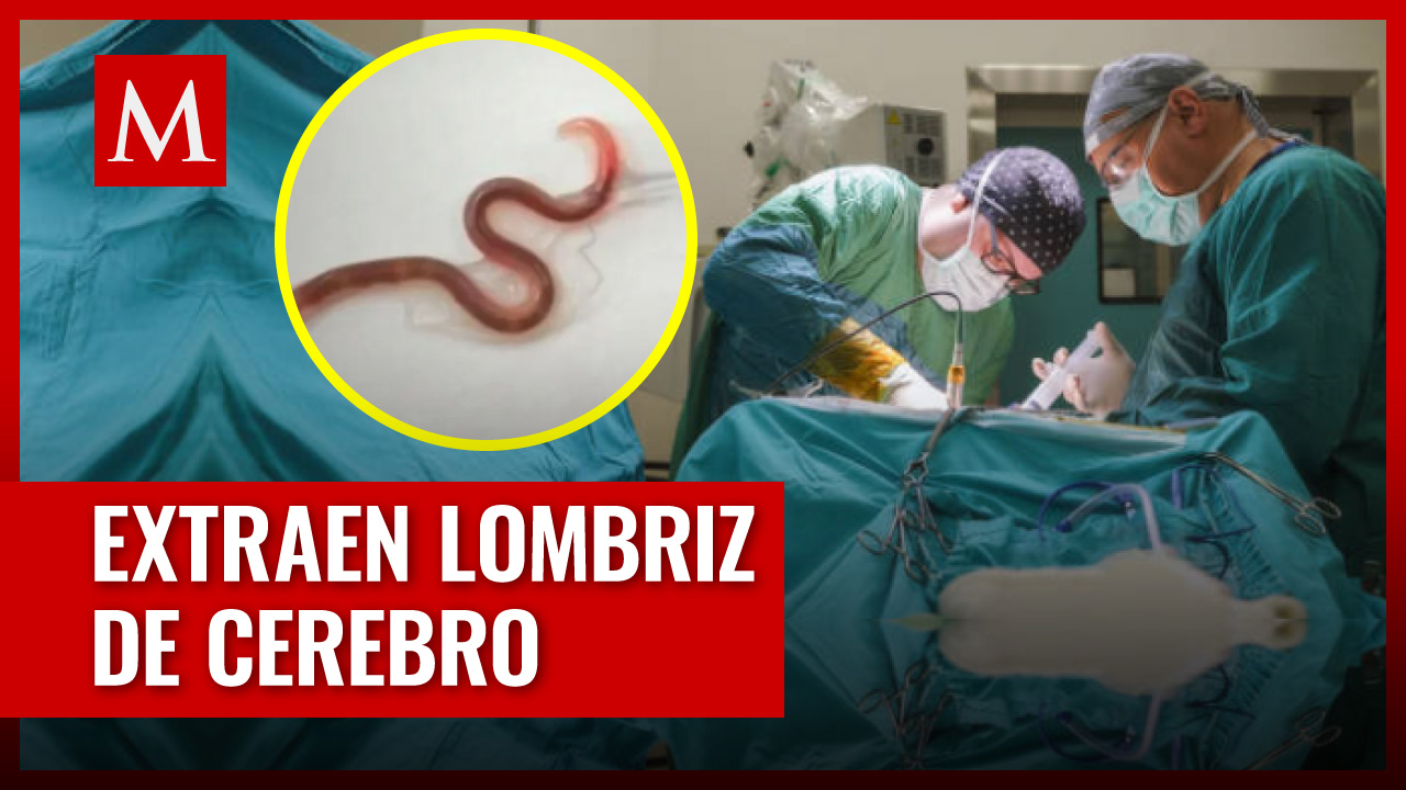 Lombriz intestinal en el cerebro: Caso médico extraordinario- Grupo Milenio