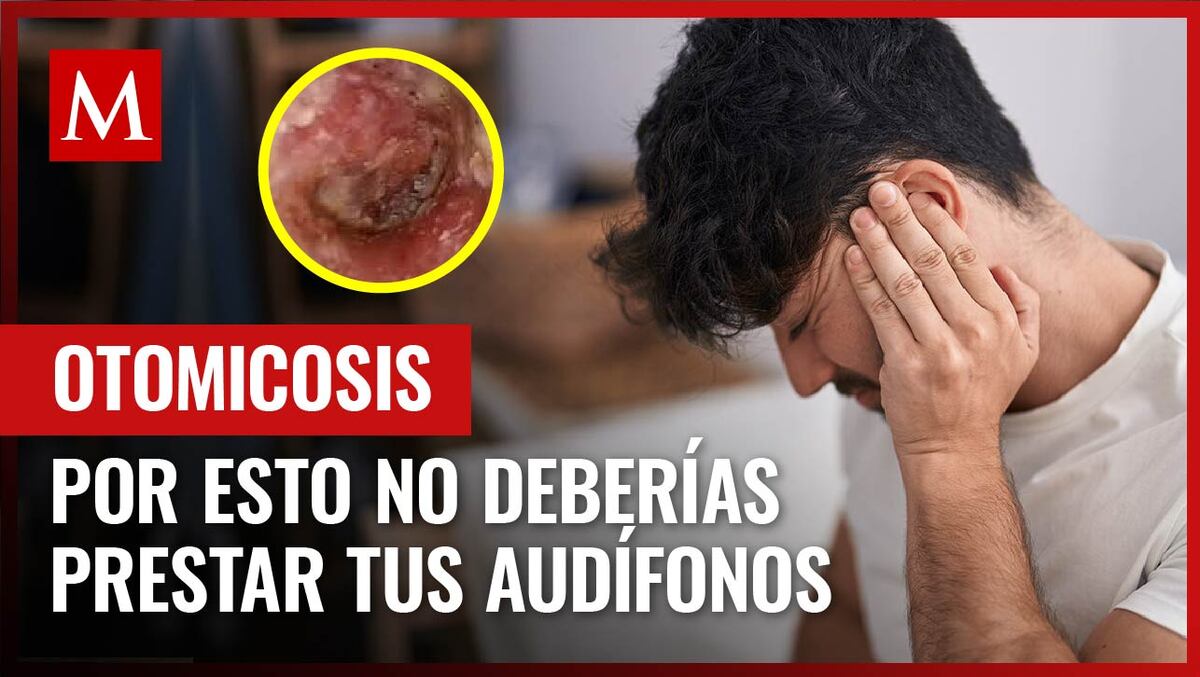 La otitis es una de las infecciones más comunes y peligrosas- Grupo Milenio
